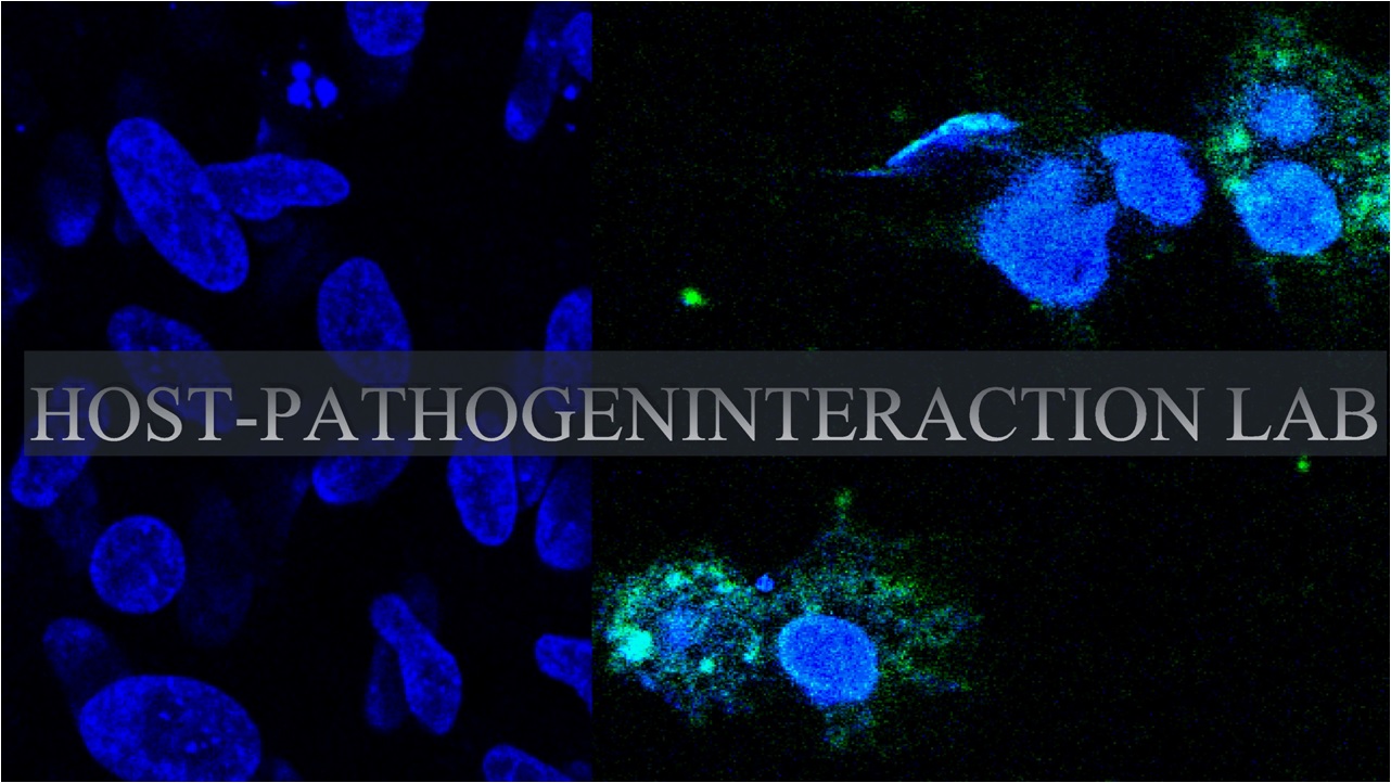 Host Pathogen Interaction Lab